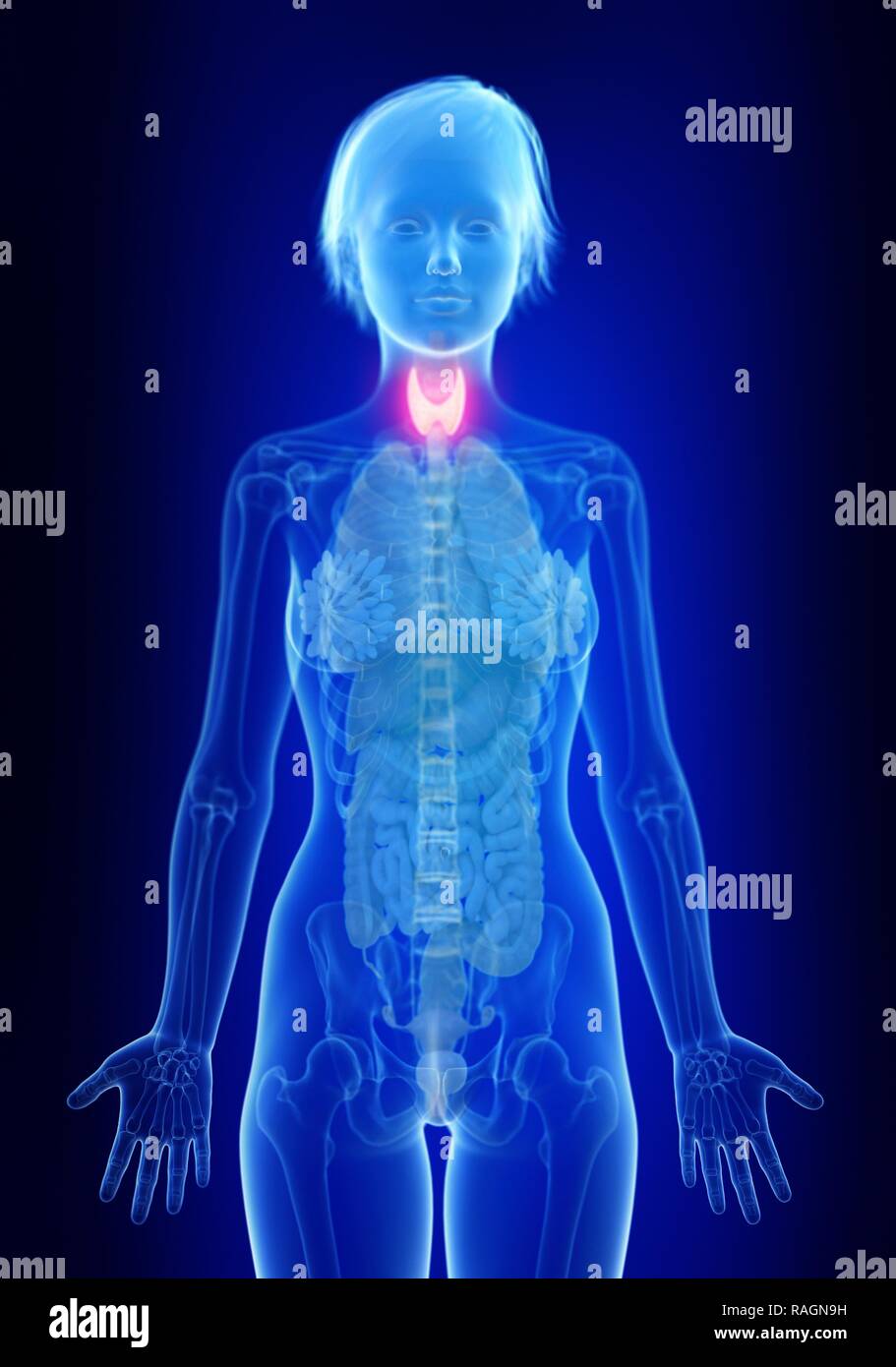 Illustration of an inflamed thyroid gland Stock Photo - Alamy