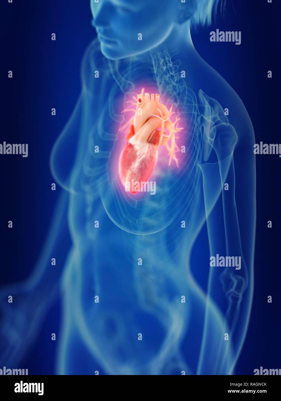 Illustration of an inflamed heart Stock Photo - Alamy