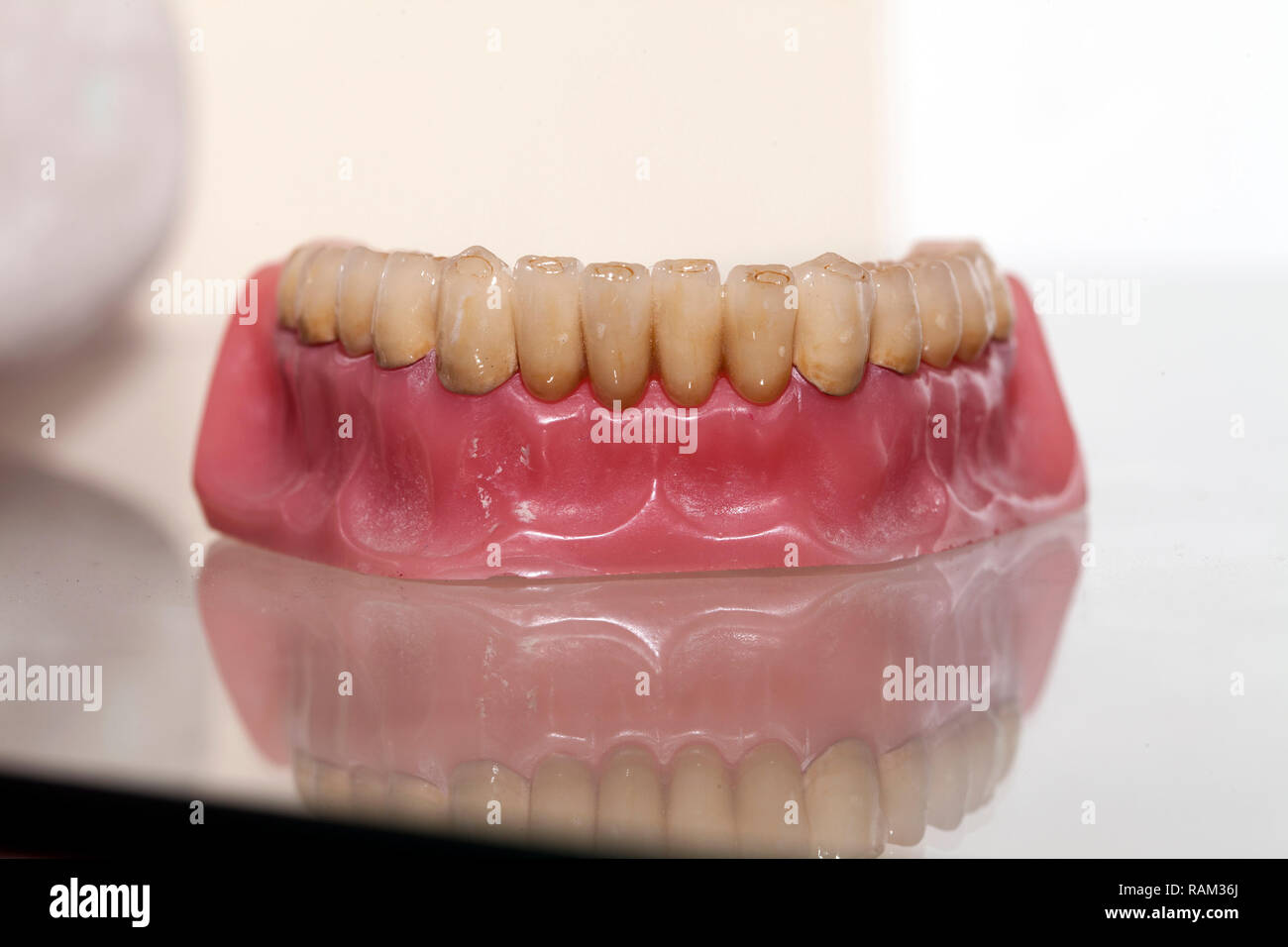 Dental prosthetic restoration hi-res stock photography and images - Alamy