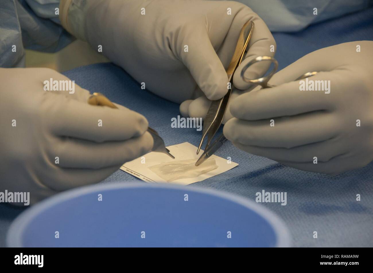 A new implant, a membrane with autologous cultured chondrocyte (healthy ...