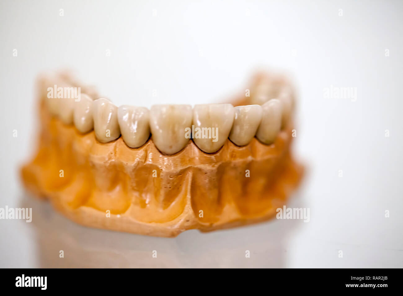 Zirconium Porcelain Tooth plate in Dentist Store Macro Detailed Photo ...