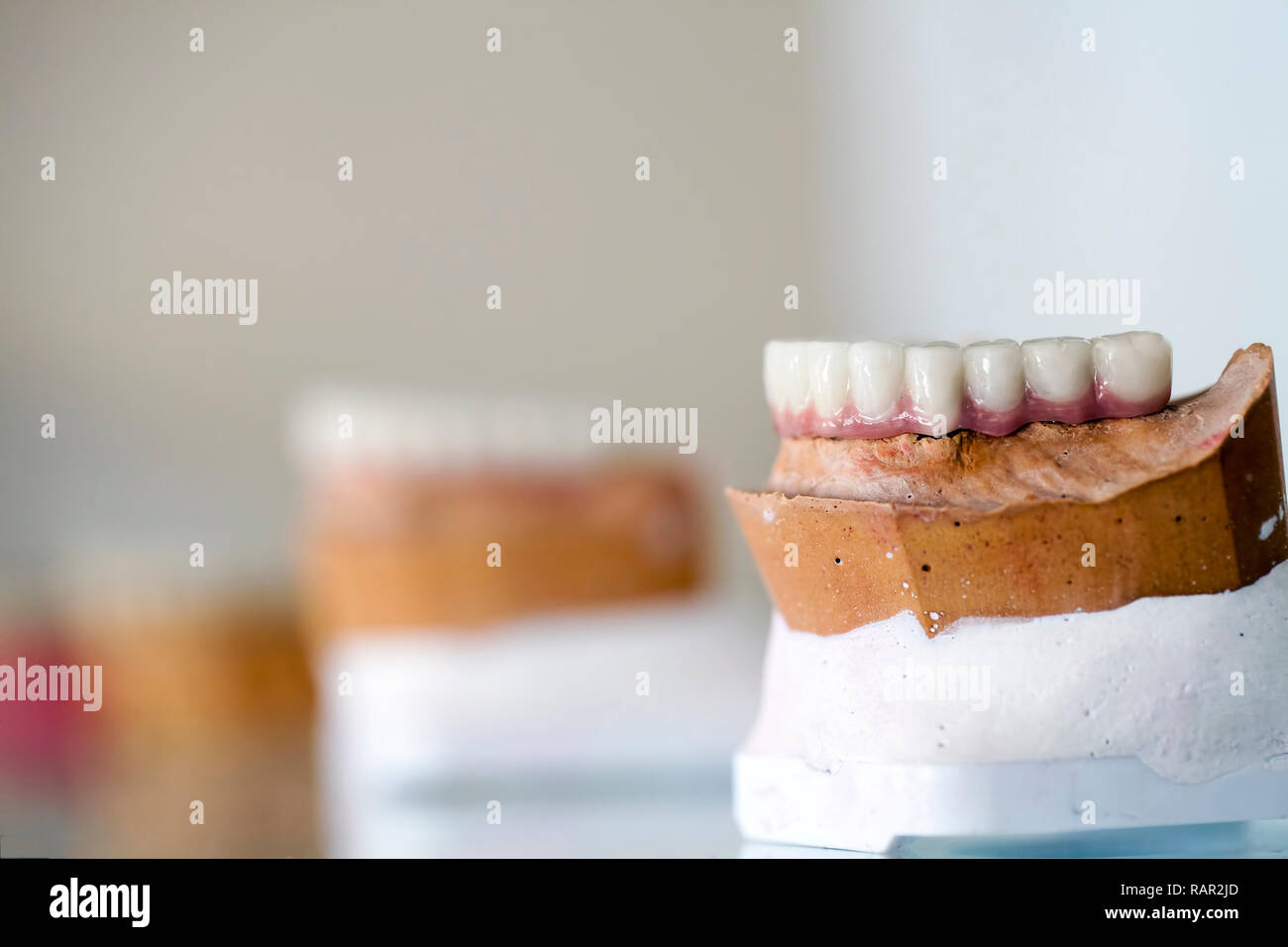 Zirconium Porcelain Tooth plate in Dentist Store Macro Detailed Photo ...