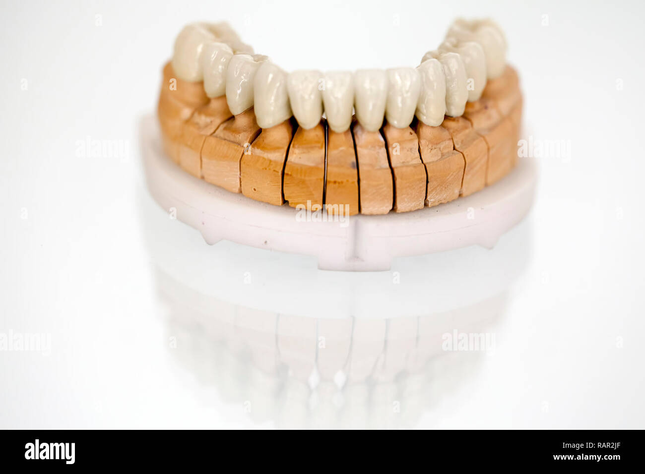 Zirconium Porcelain Tooth plate in Dentist Store Macro Detailed Photo ...