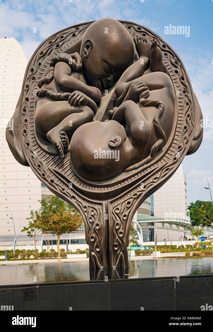 New sculptures showing stages of childbirth in the uterus at Sidra ...