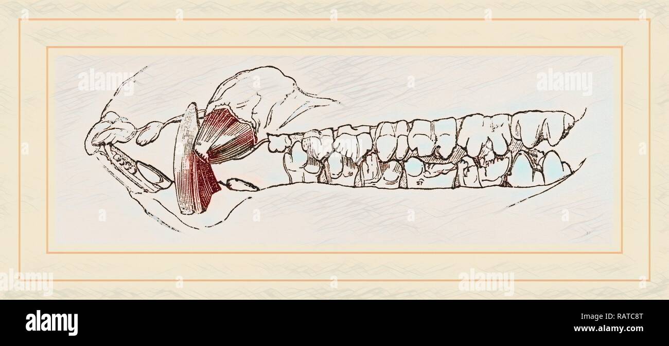 Teeth of the Hog. Reimagined by Gibon. Classic art with a modern twist ...