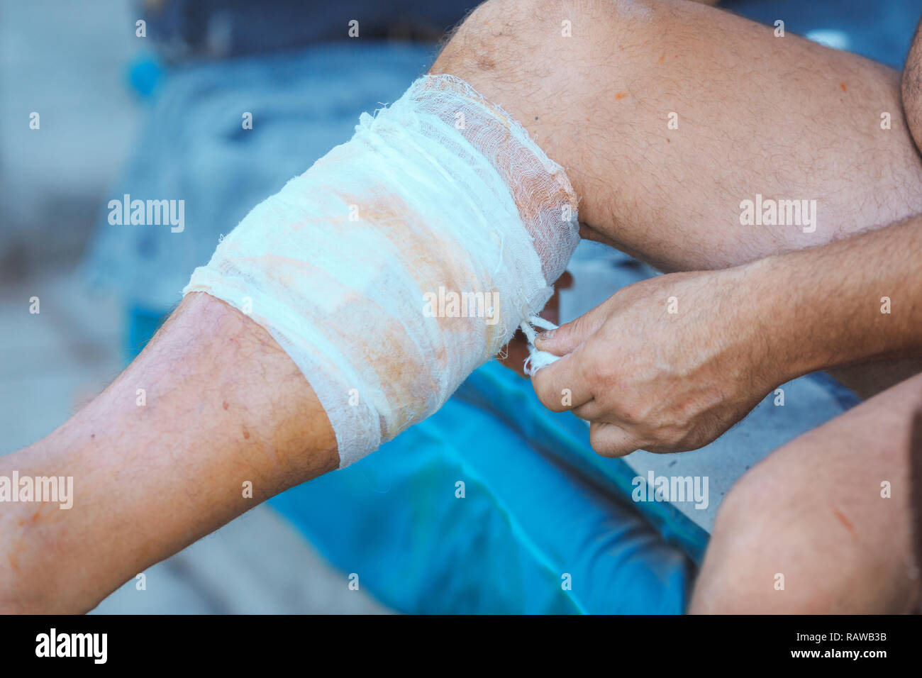 Injured healthcare and medicine patient bandage hi-res stock ...