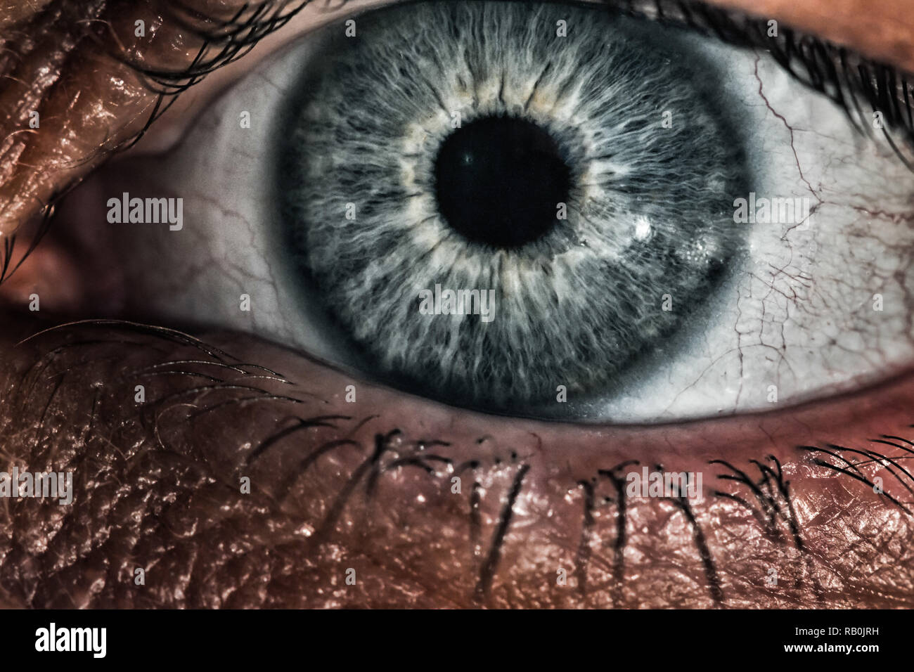 Bloodshot eye hi-res stock photography and images - Alamy