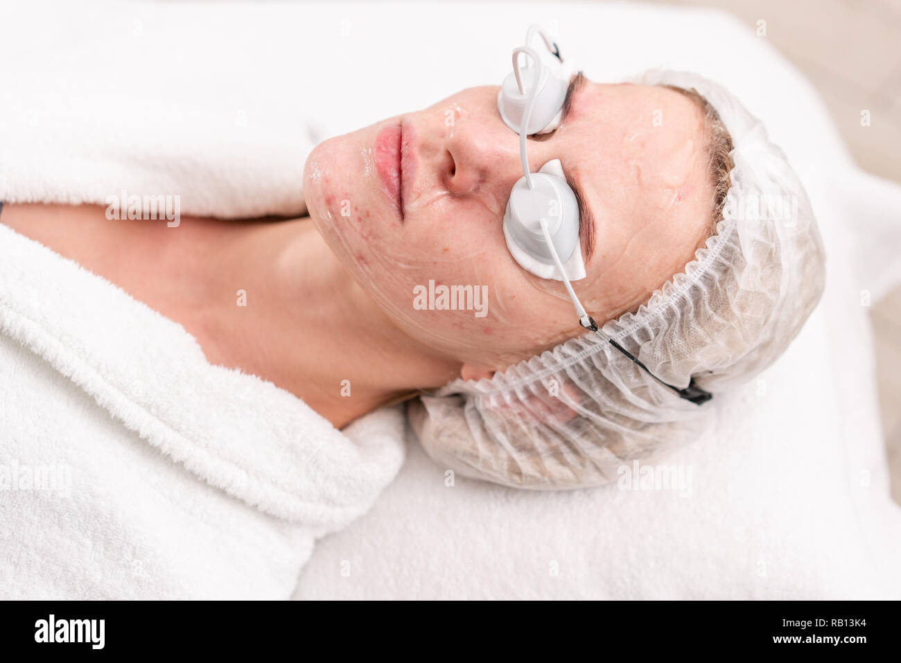 Portrait of a young woman patient. Anti acne phototherapy with ...
