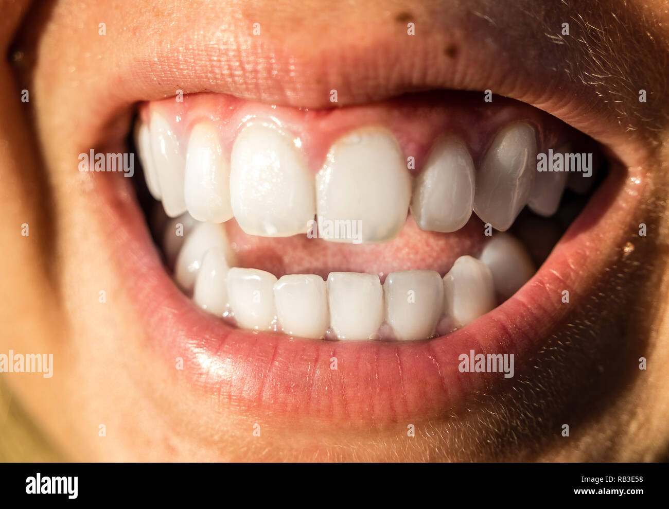 beautiful White teeth Stock Photo - Alamy