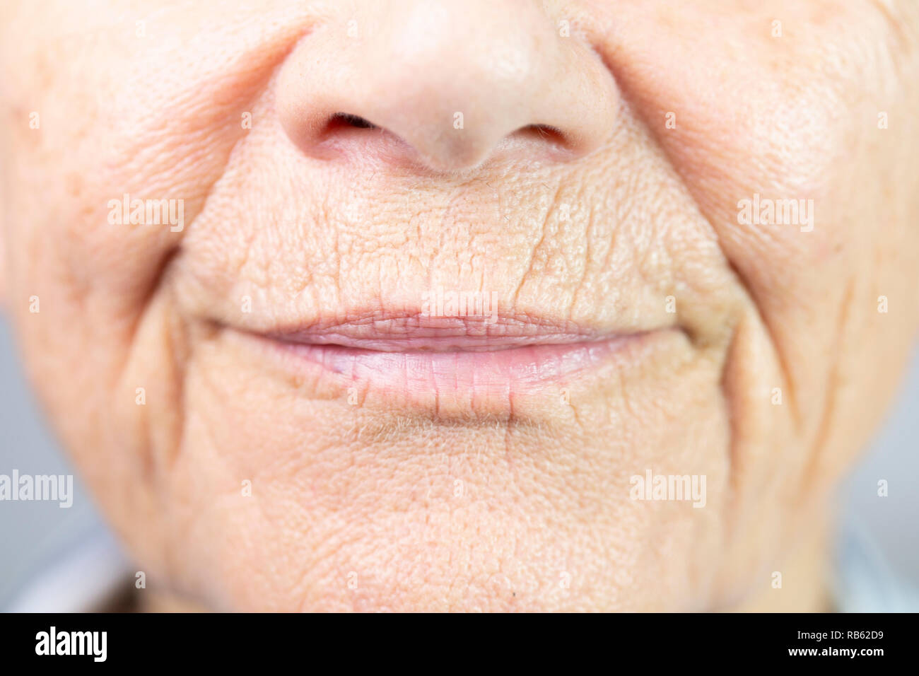 Anemia face hi-res stock photography and images - Alamy