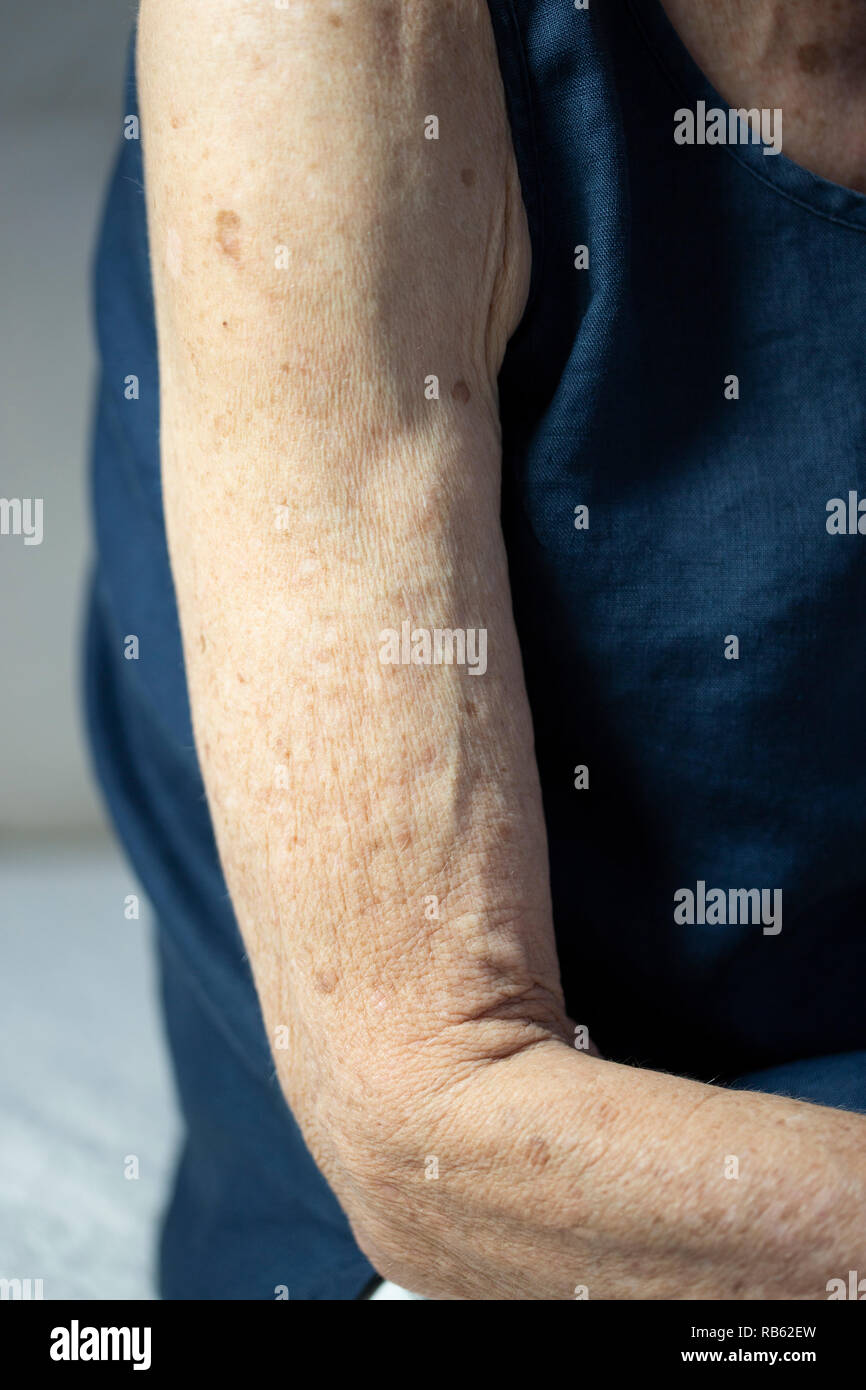 Arm of old woman Stock Photo - Alamy