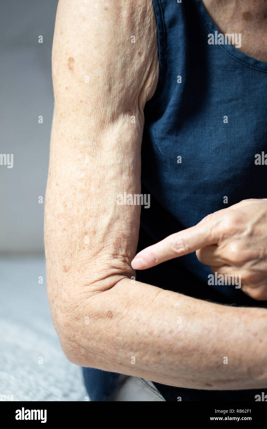 Arm of old woman Stock Photo - Alamy