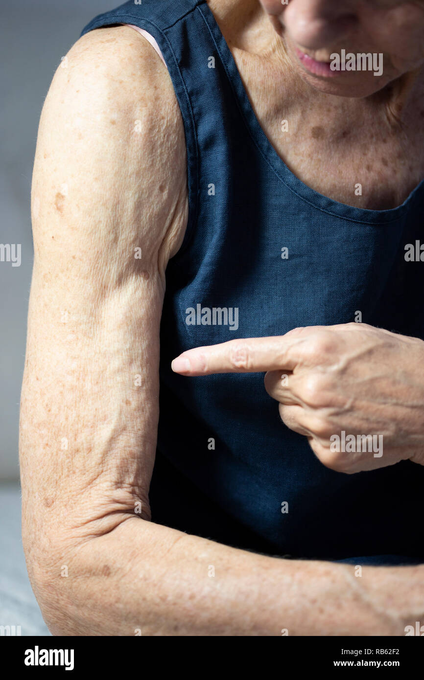 Arm of old woman Stock Photo - Alamy