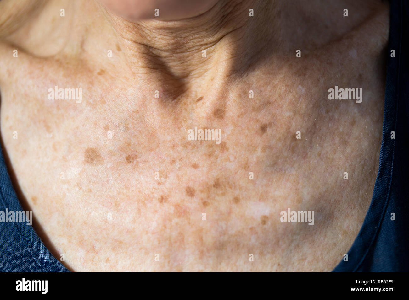 Neck of old woman Stock Photo - Alamy
