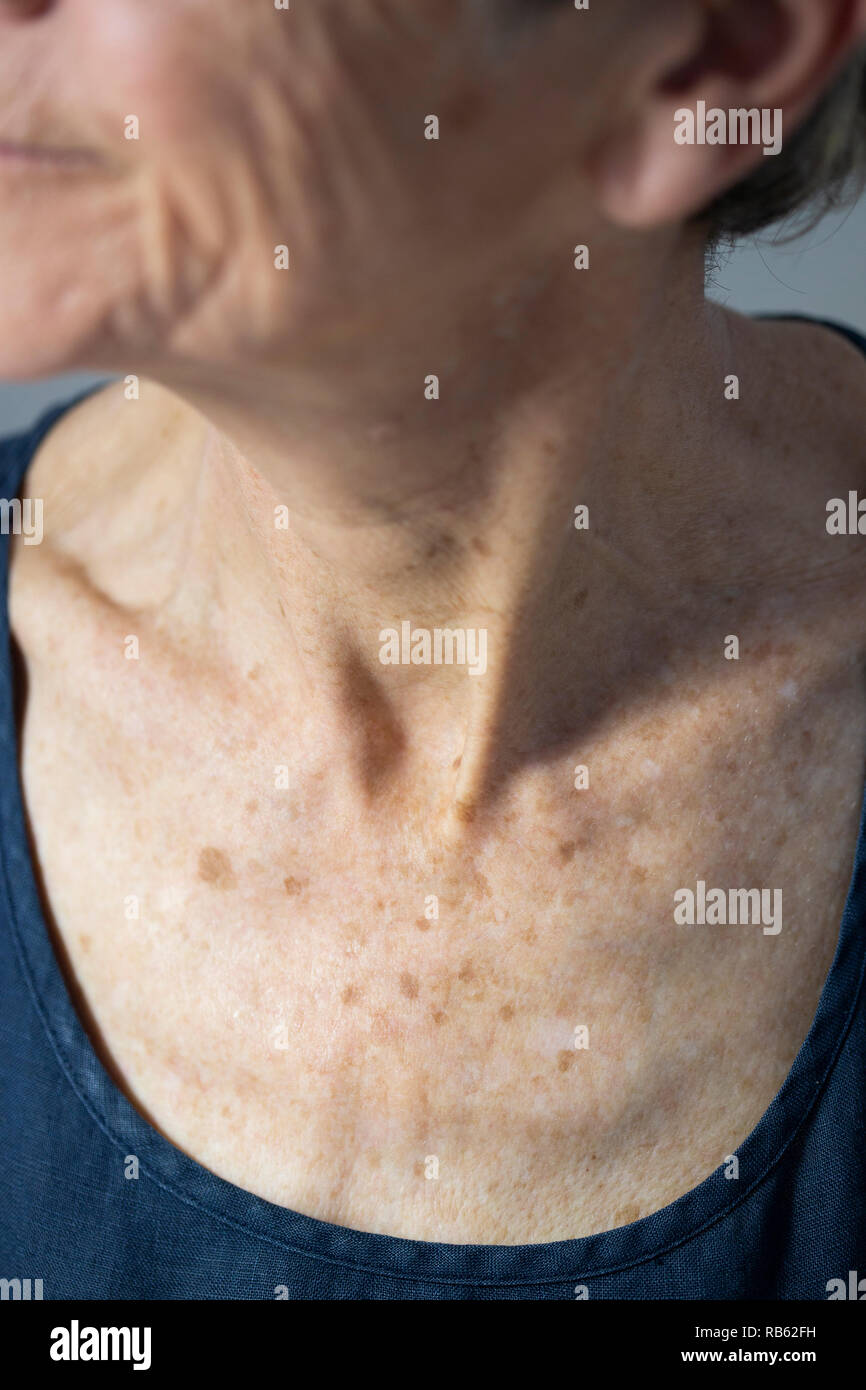 Chest of old woman Stock Photo - Alamy