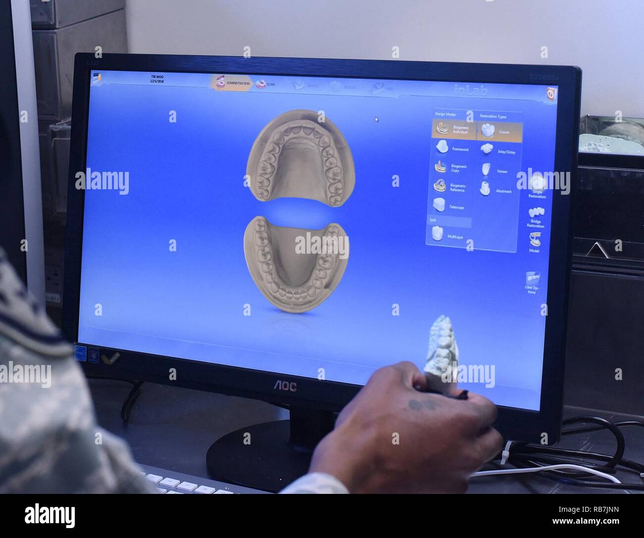 Computer aided design medical hi-res stock photography and images - Alamy