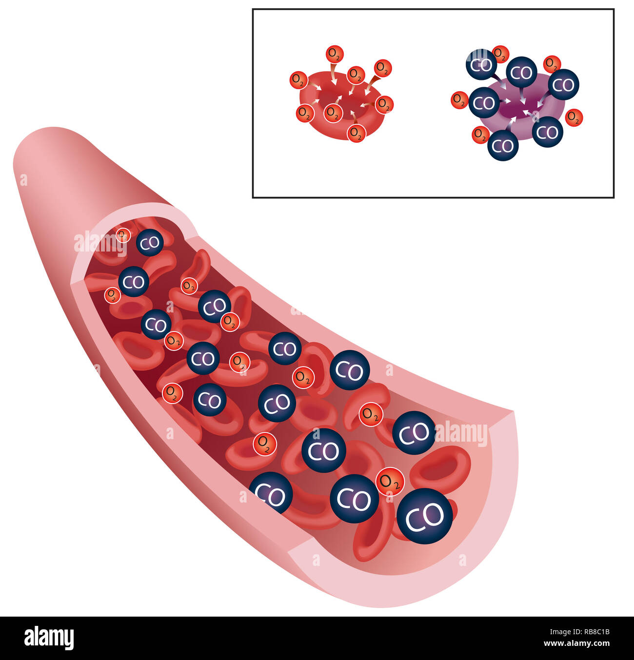 Carbon monoxide poisoning hi-res stock photography and images - Alamy