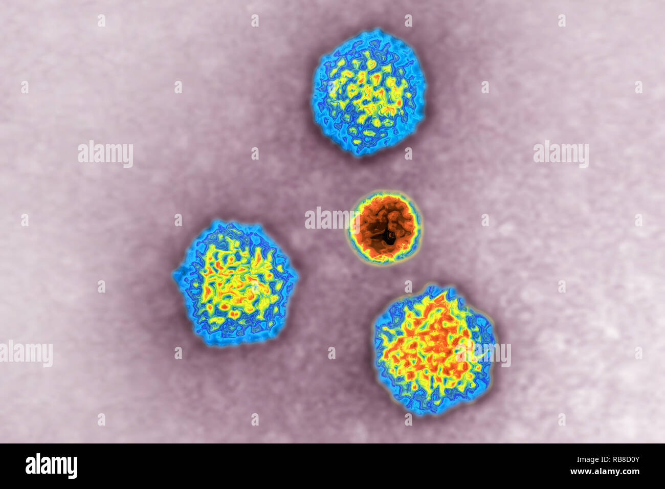 Adenovirus electron hi-res stock photography and images - Alamy