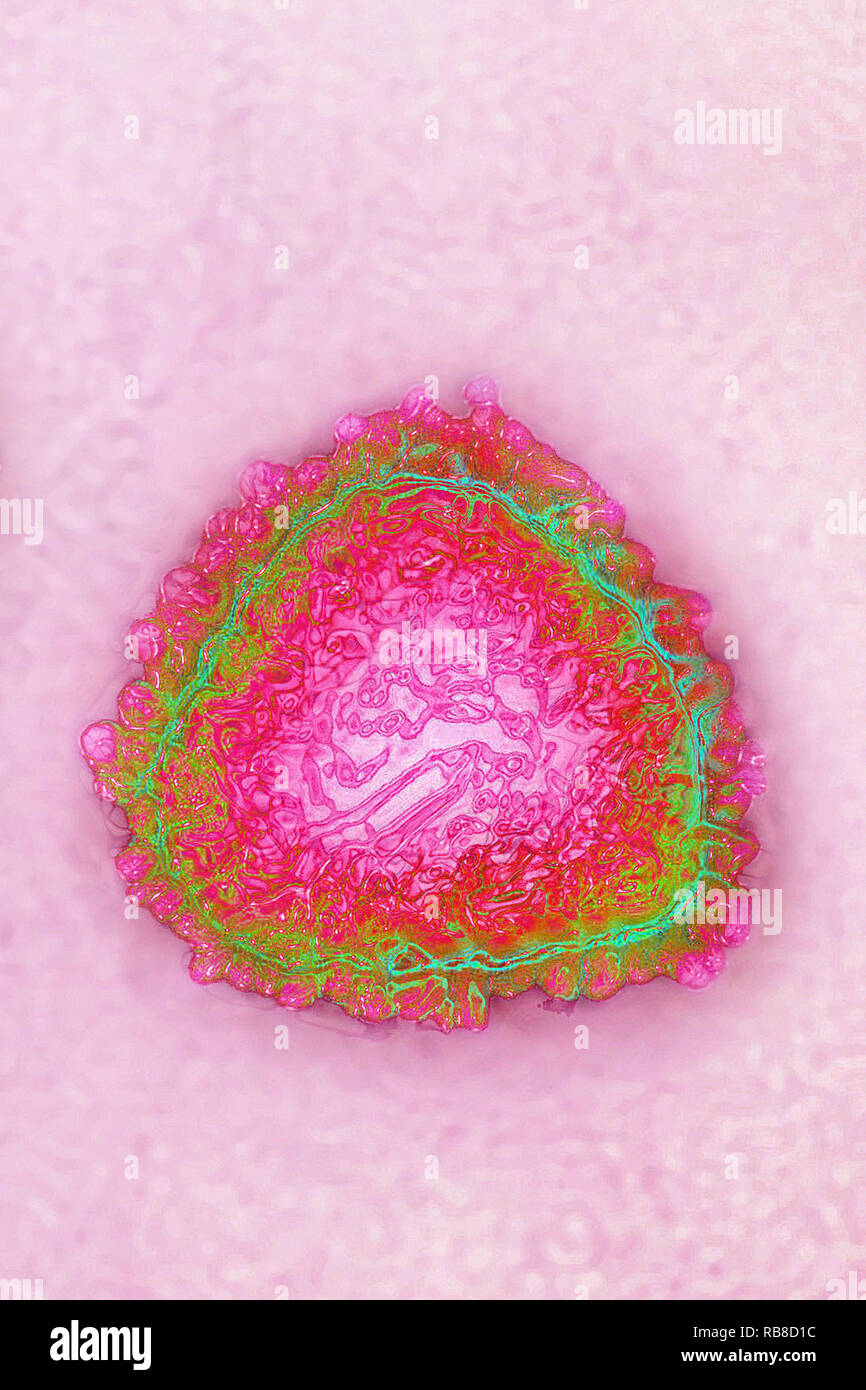 Viral enteritis hi-res stock photography and images - Alamy