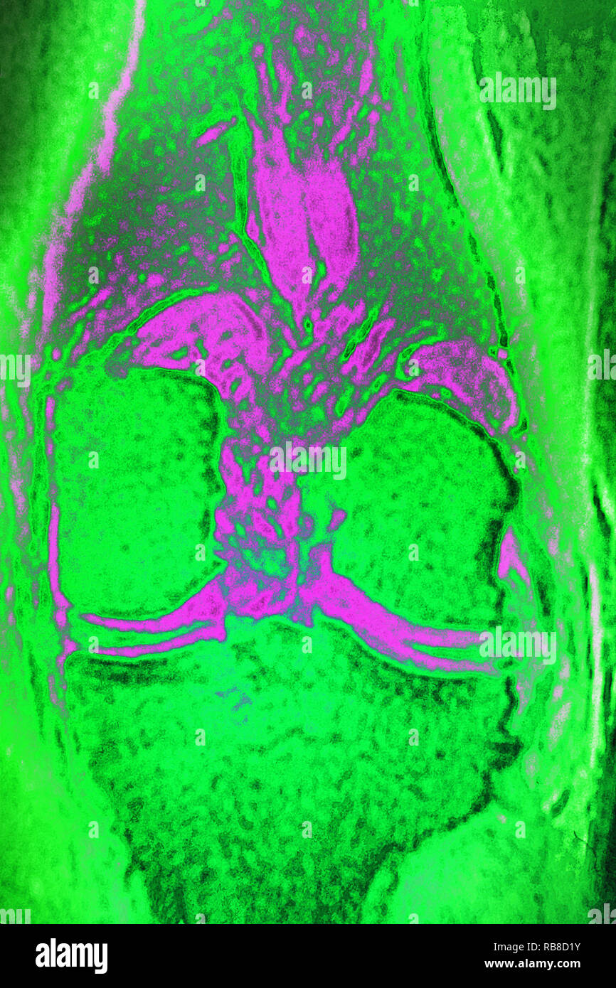 Normal knee hi-res stock photography and images - Alamy