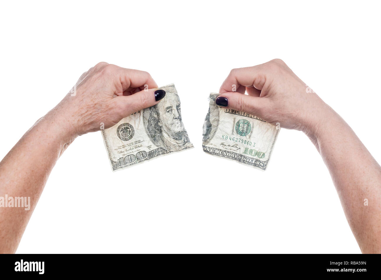 White Spots On Female Hands Hi Res Stock Photography And Images Alamy