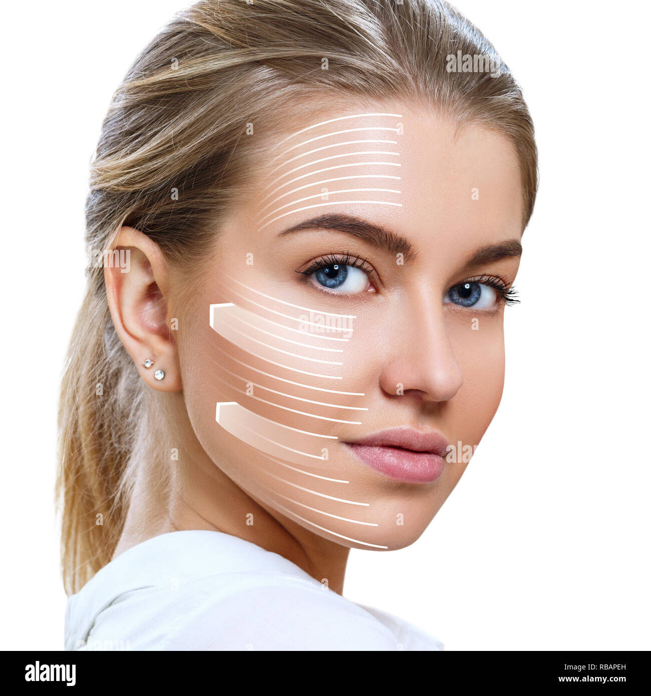 Graphic lines shows facial lifting effect on skin. Isolated on white ...