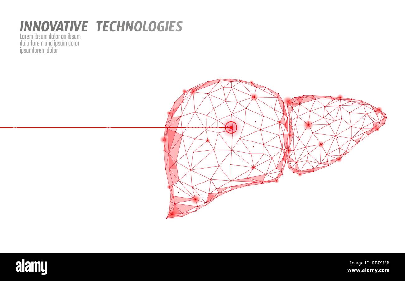 Human liver laser surgery operation low poly. Medicine disease drug ...