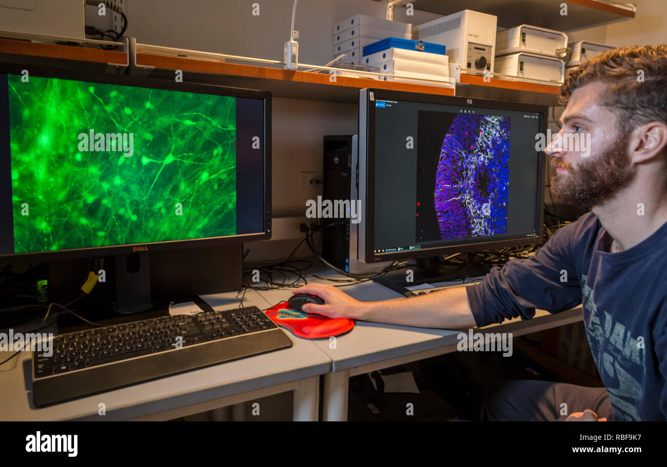 Organoid brain hi-res stock photography and images - Alamy