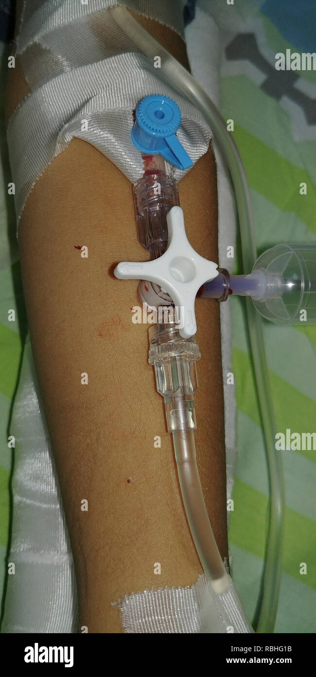 Intravenous Infusion