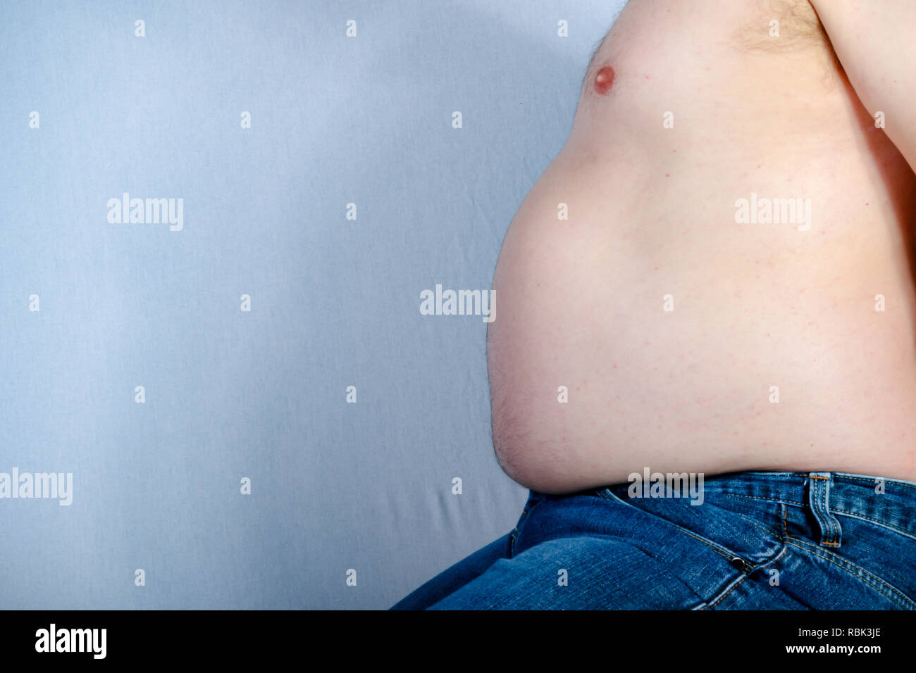 Fat Obese Stomach Sitting Stock Photos & Fat Obese Stomach Sitting ...