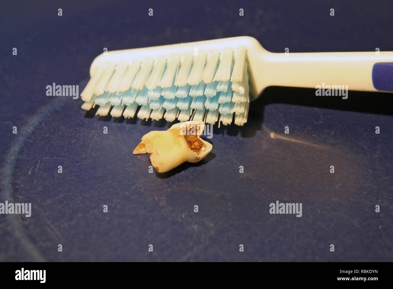 Bad tooth and toothbrush. Rotten tooth and toothbrush. Importance of ...