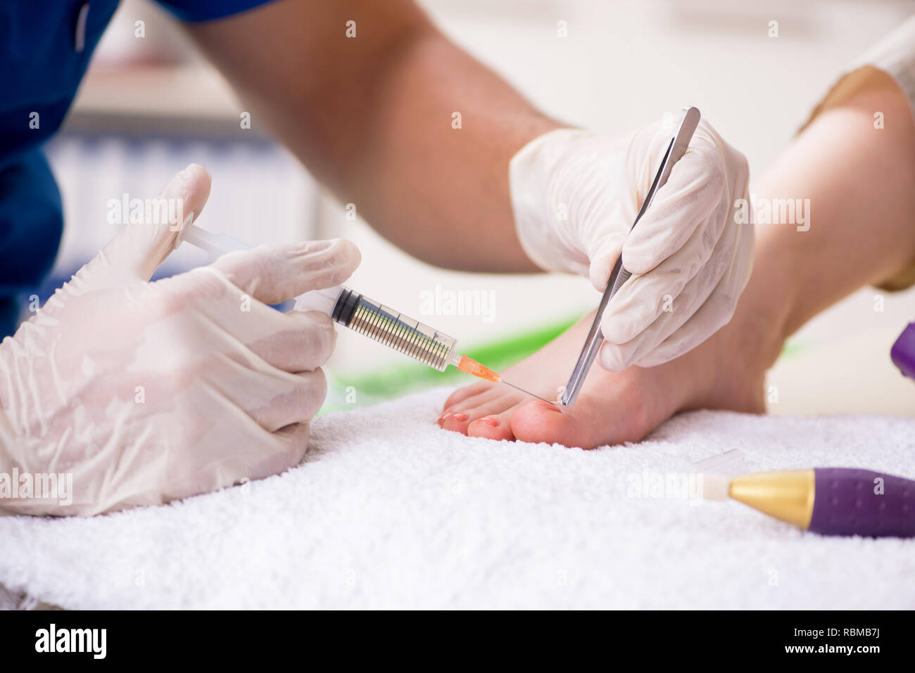 Podiatrist treating feet during procedure Stock Photo - Alamy