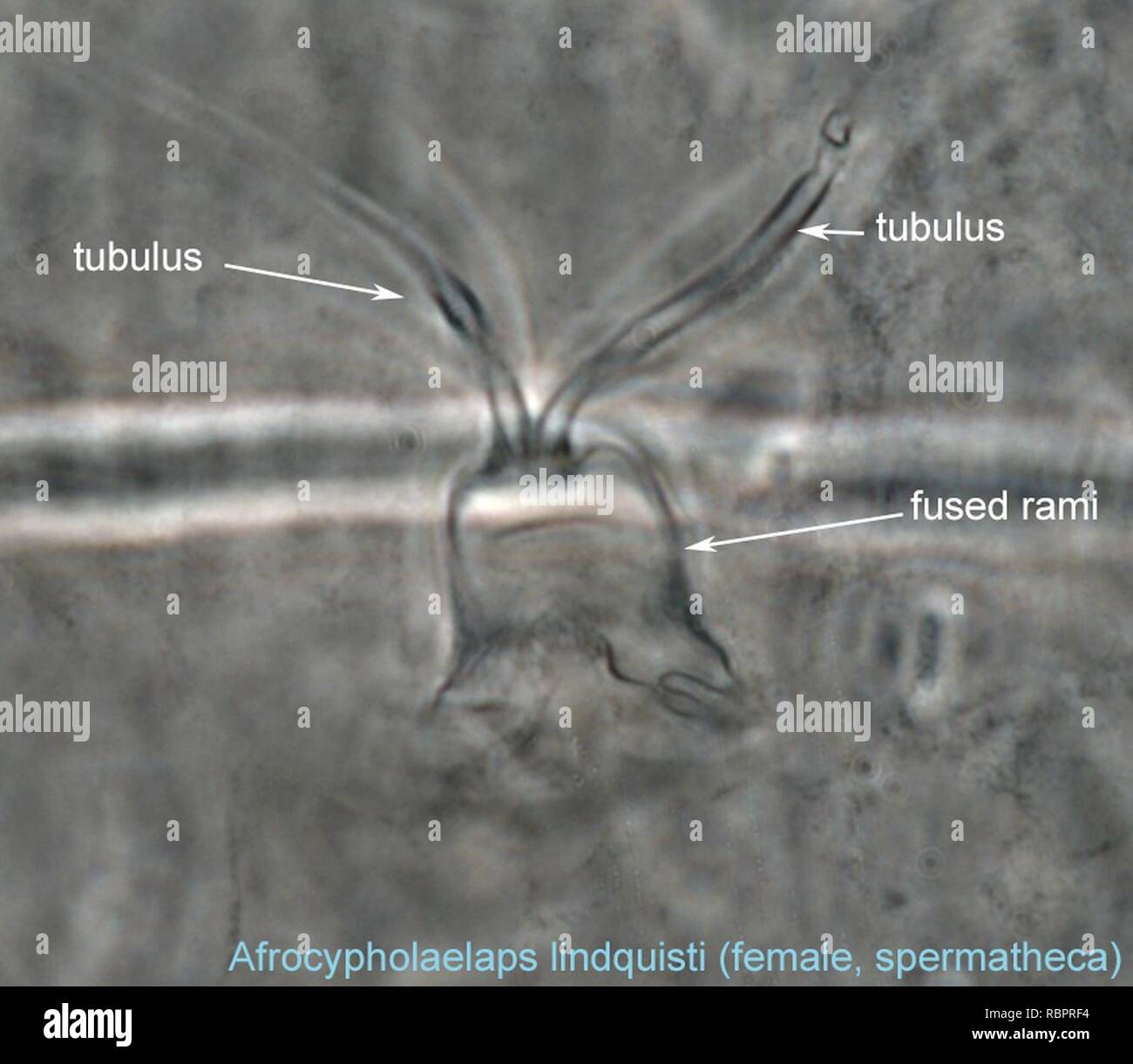 Spermatheca hi-res stock photography and images - Alamy