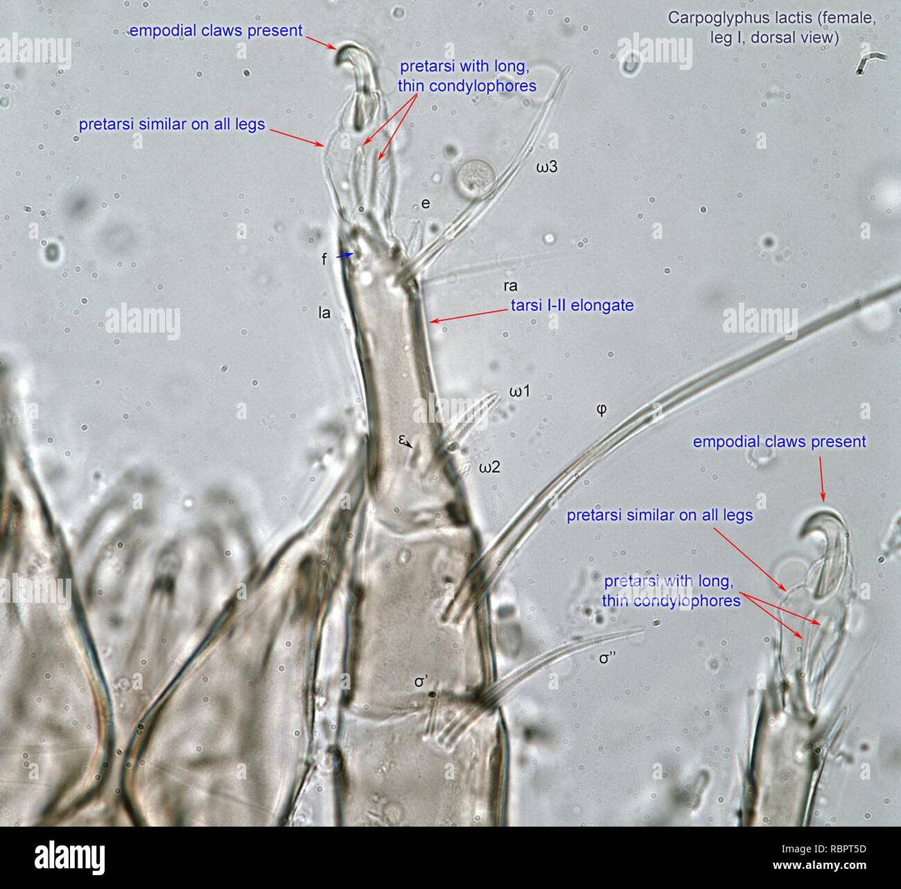 11-Carpoglyphus lactis Vladivostok female2 legI BF100 Stock Photo - Alamy