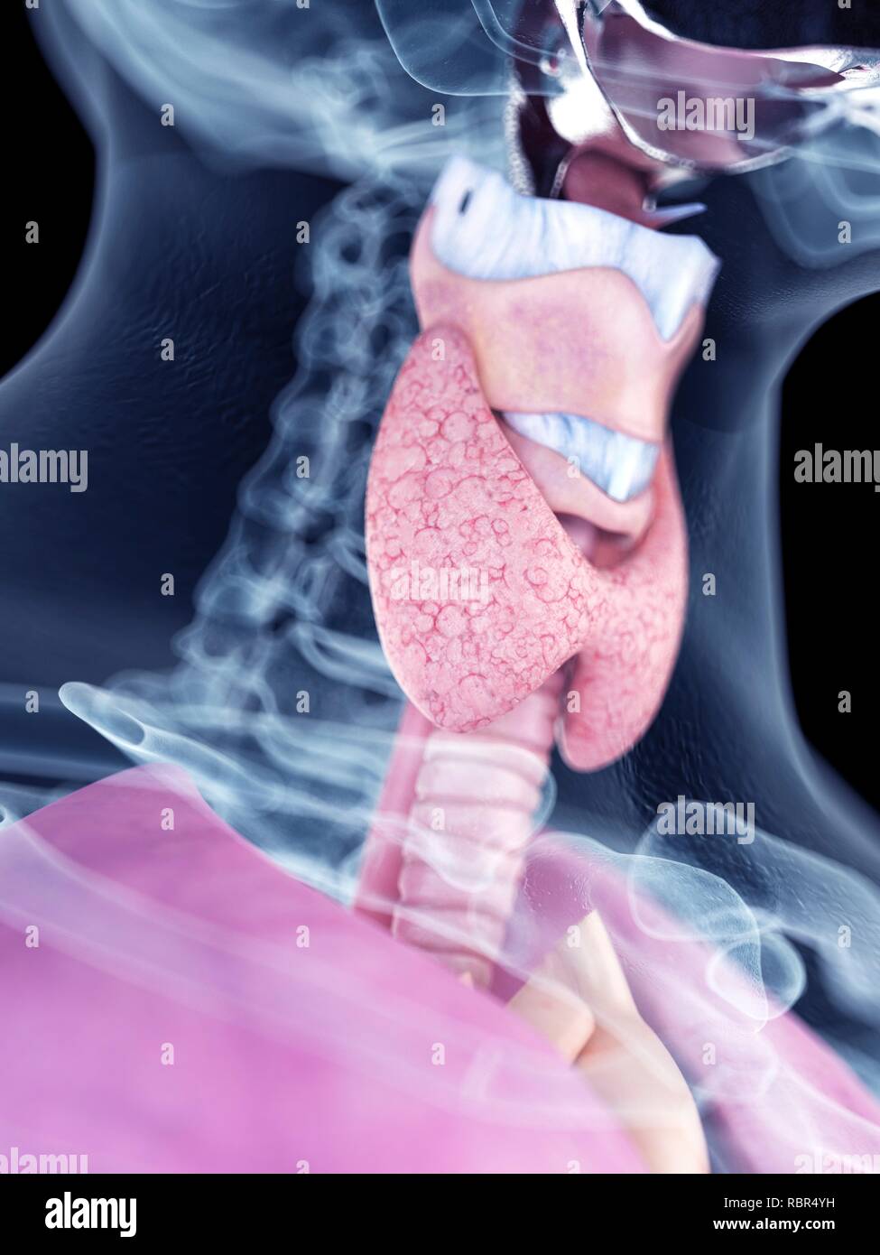 Goiter, Neck Stock Photos & Goiter, Neck Stock Images - Alamy