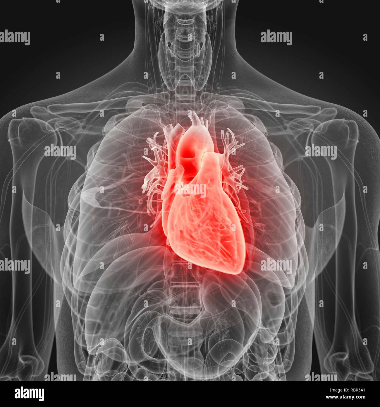 Illustration of an inflamed heart Stock Photo - Alamy