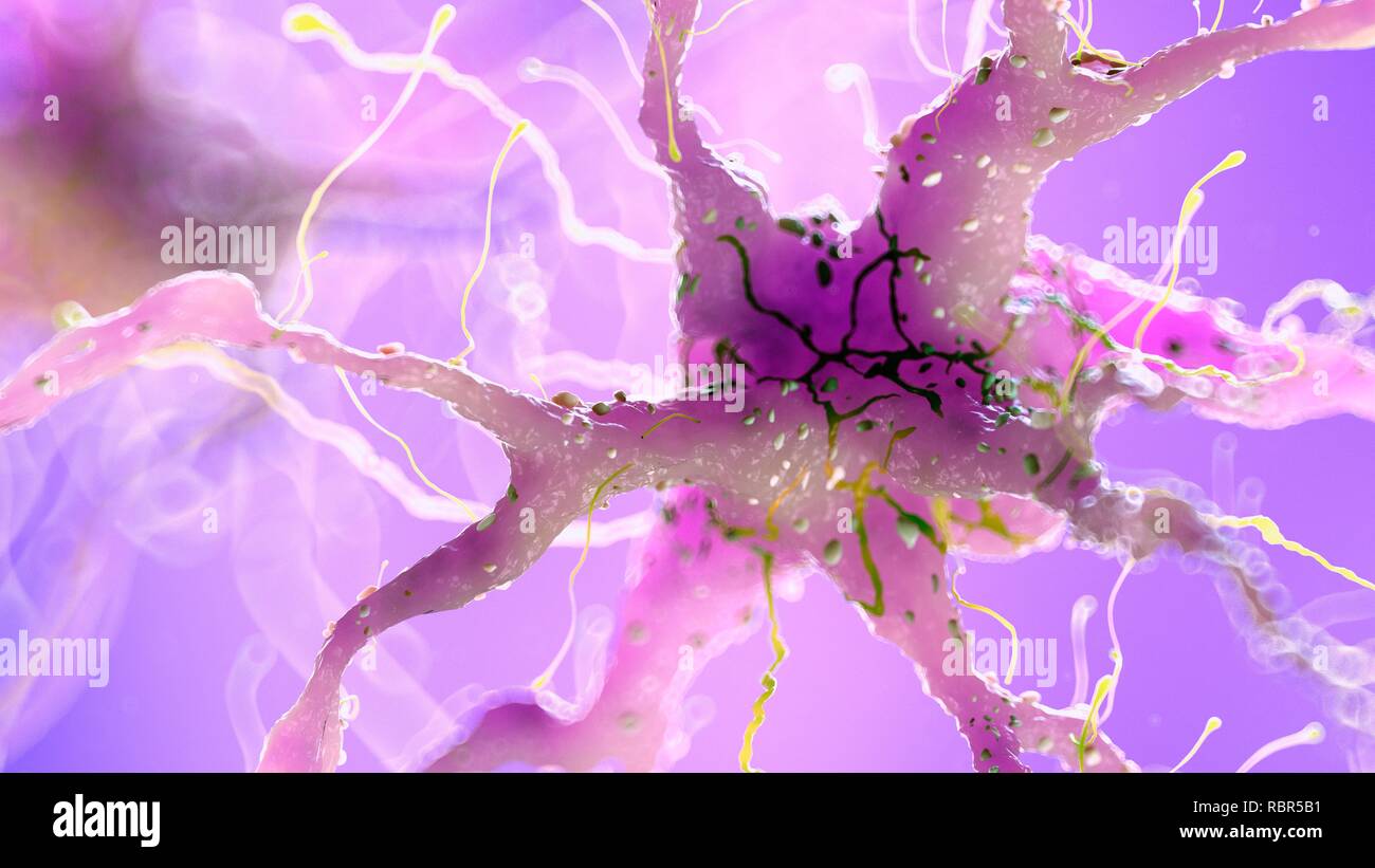 Alzheimer damaged hi-res stock photography and images - Alamy