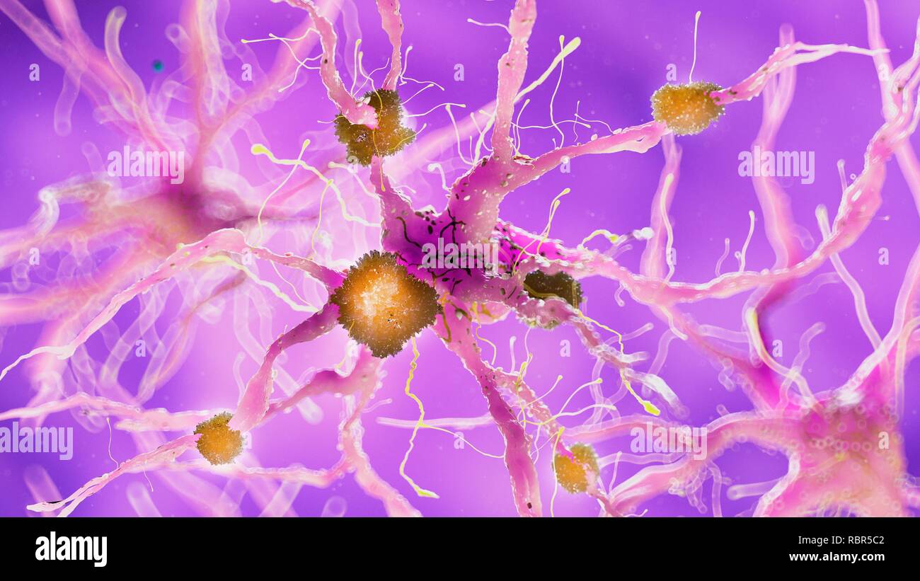 Illustration of amyloid plaques on a nerve cell Stock Photo - Alamy