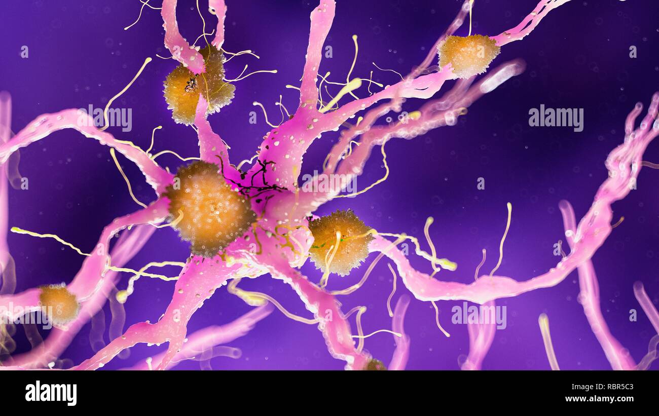 Illustration of amyloid plaques on a nerve cell Stock Photo - Alamy