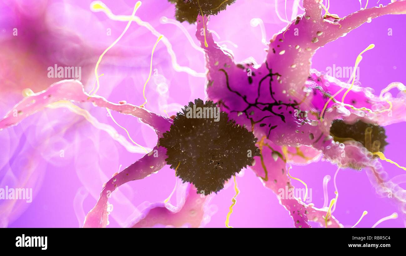 Illustration of amyloid plaques on a nerve cell Stock Photo - Alamy