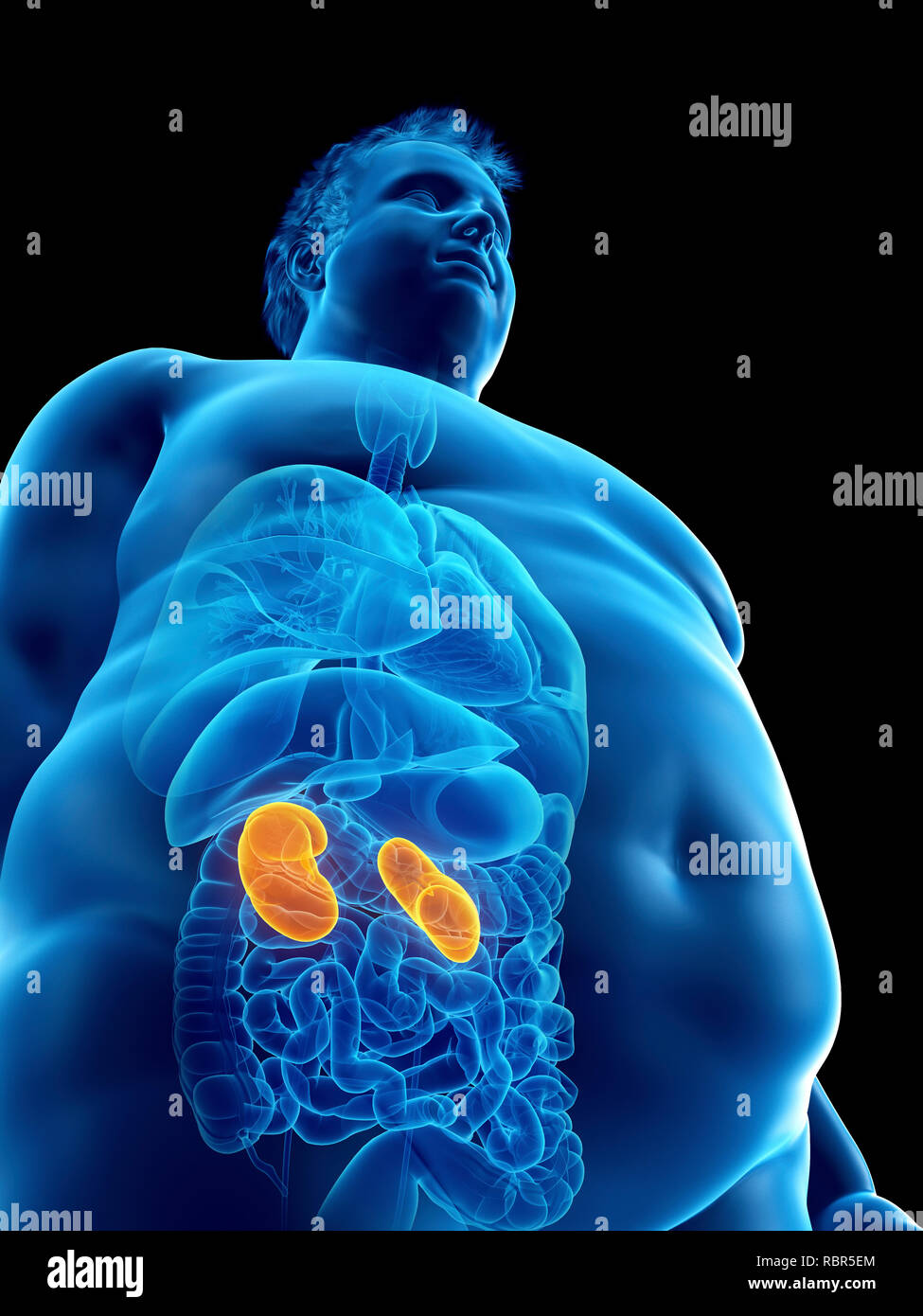 Illustration of an obese man's kidneys Stock Photo - Alamy