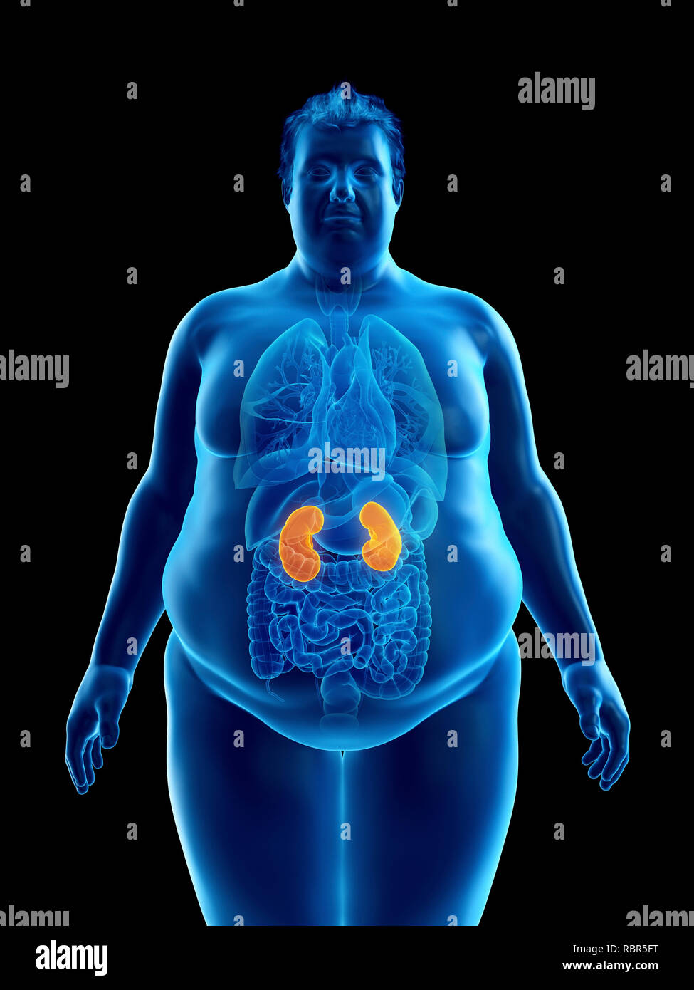 Illustration of an obese man's kidneys Stock Photo - Alamy