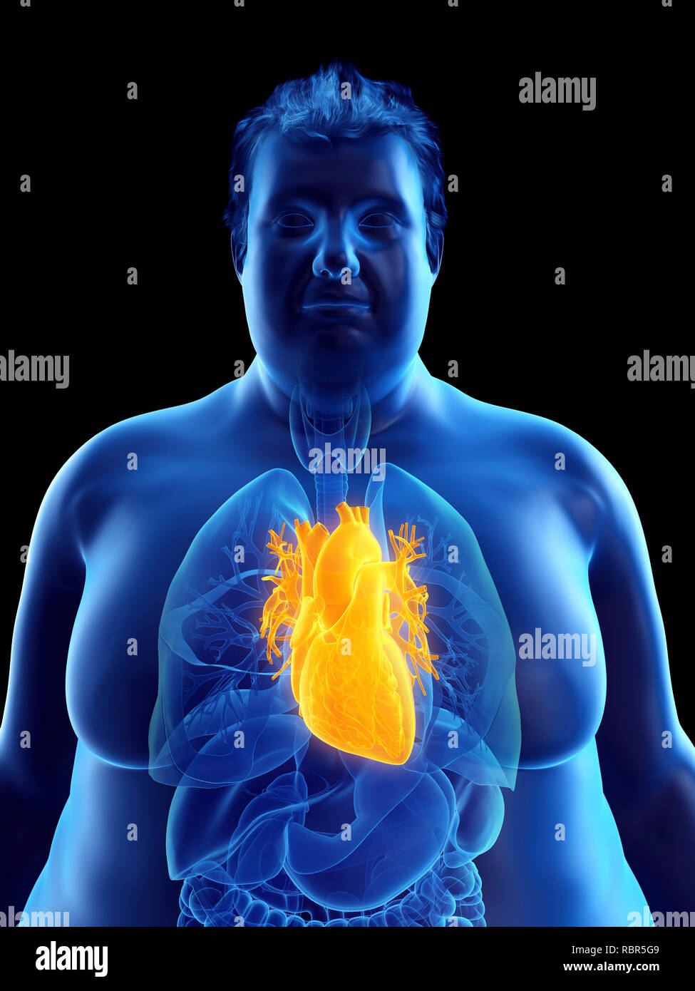 Illustration of an obese man's heart Stock Photo - Alamy