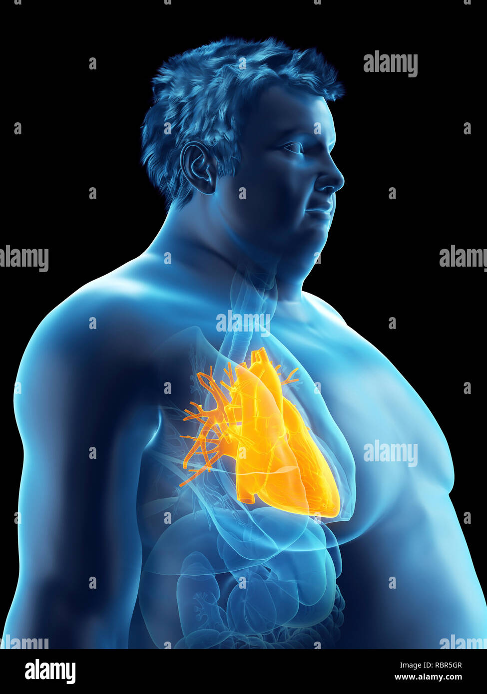 Illustration of an obese man's heart Stock Photo - Alamy