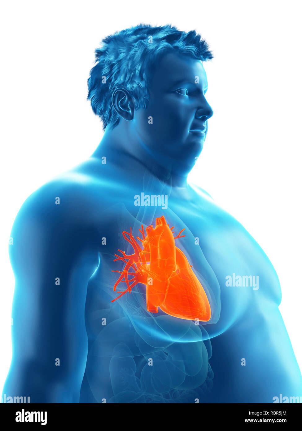 Illustration of an obese man's heart Stock Photo - Alamy