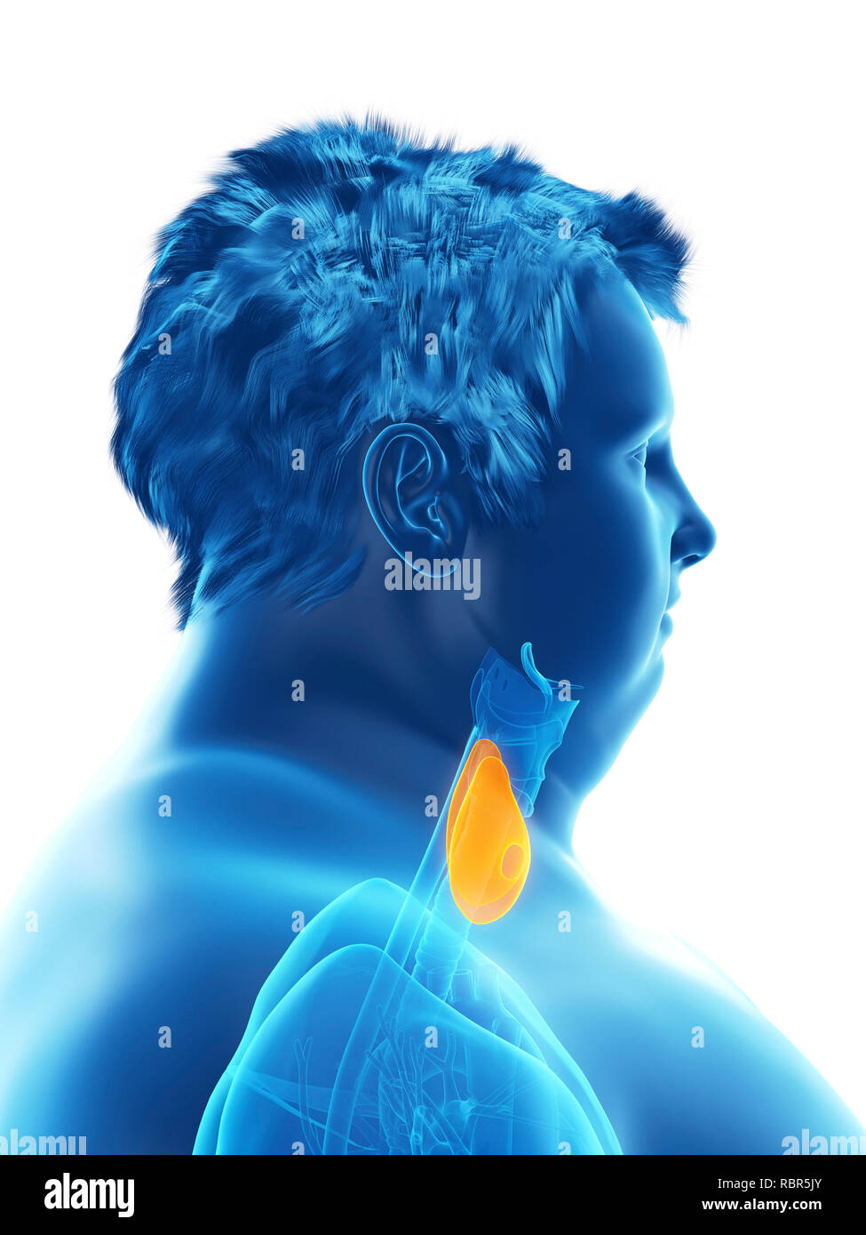 Illustration of an obese man's thyroid gland Stock Photo - Alamy