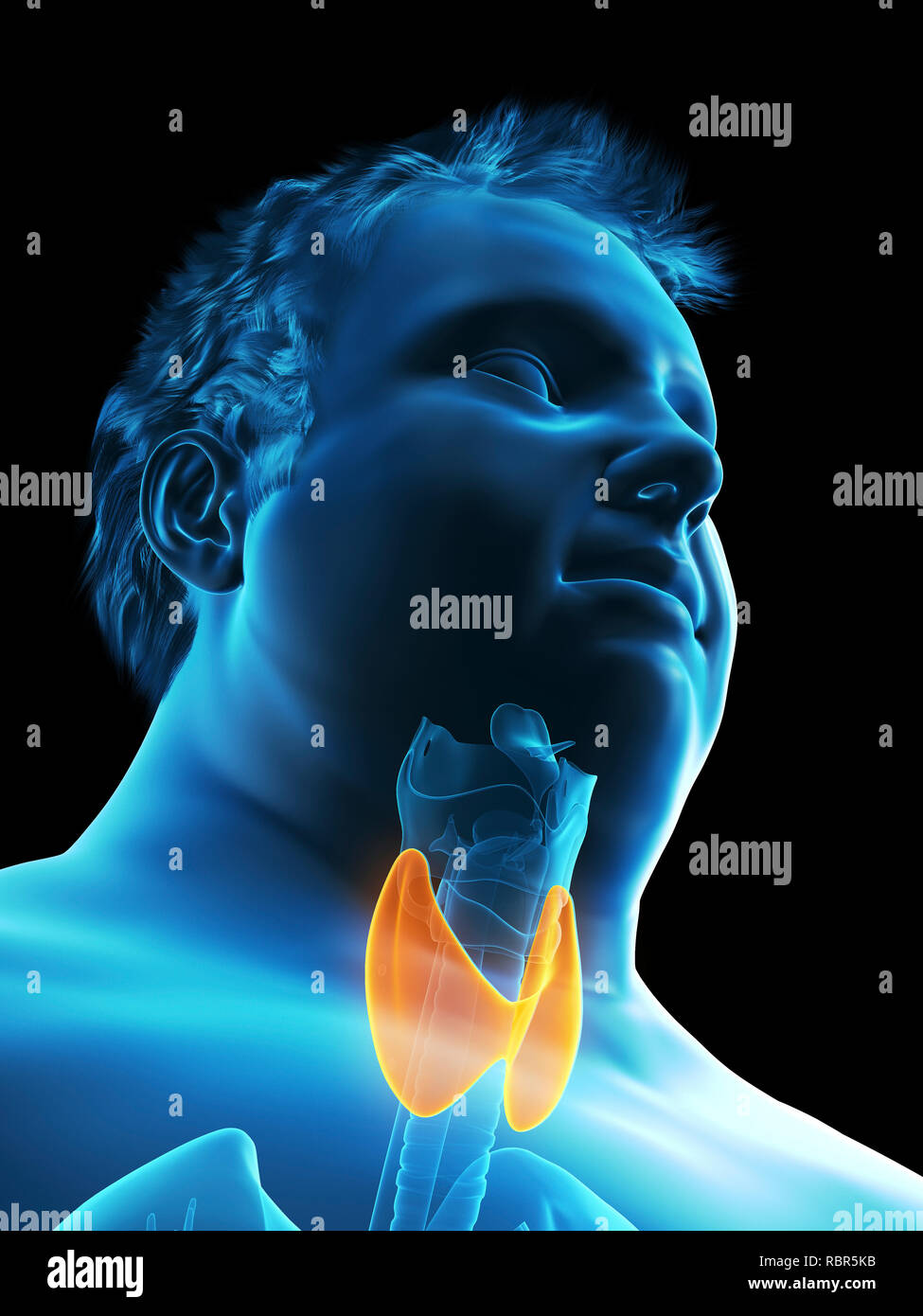 Illustration of an obese man's thyroid gland Stock Photo - Alamy
