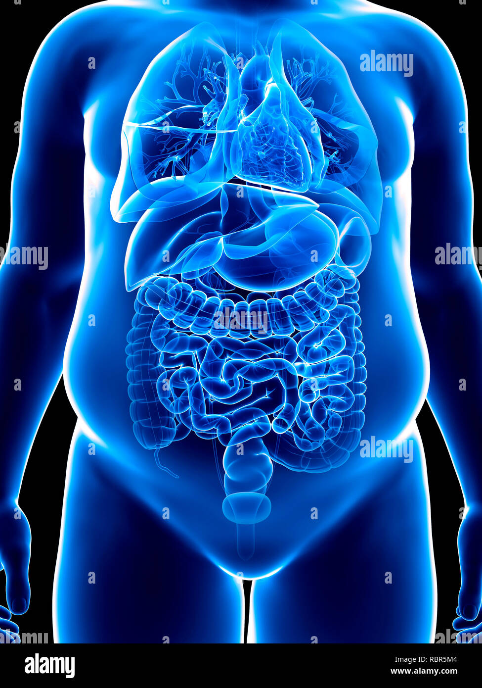 Illustration of an obese man's organs Stock Photo - Alamy
