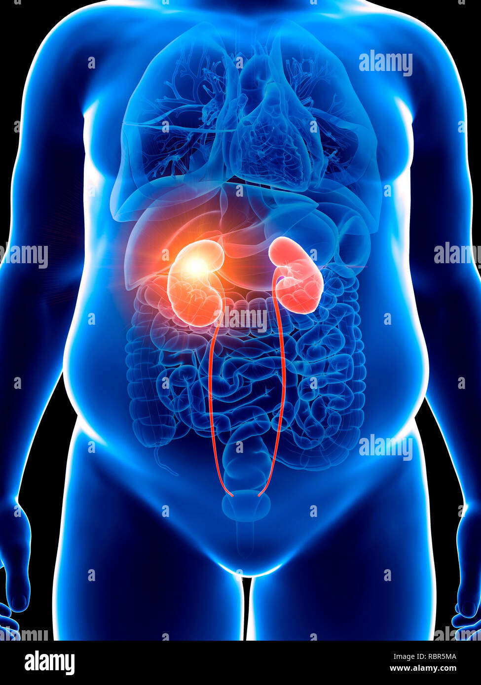 Kidney Location In Men