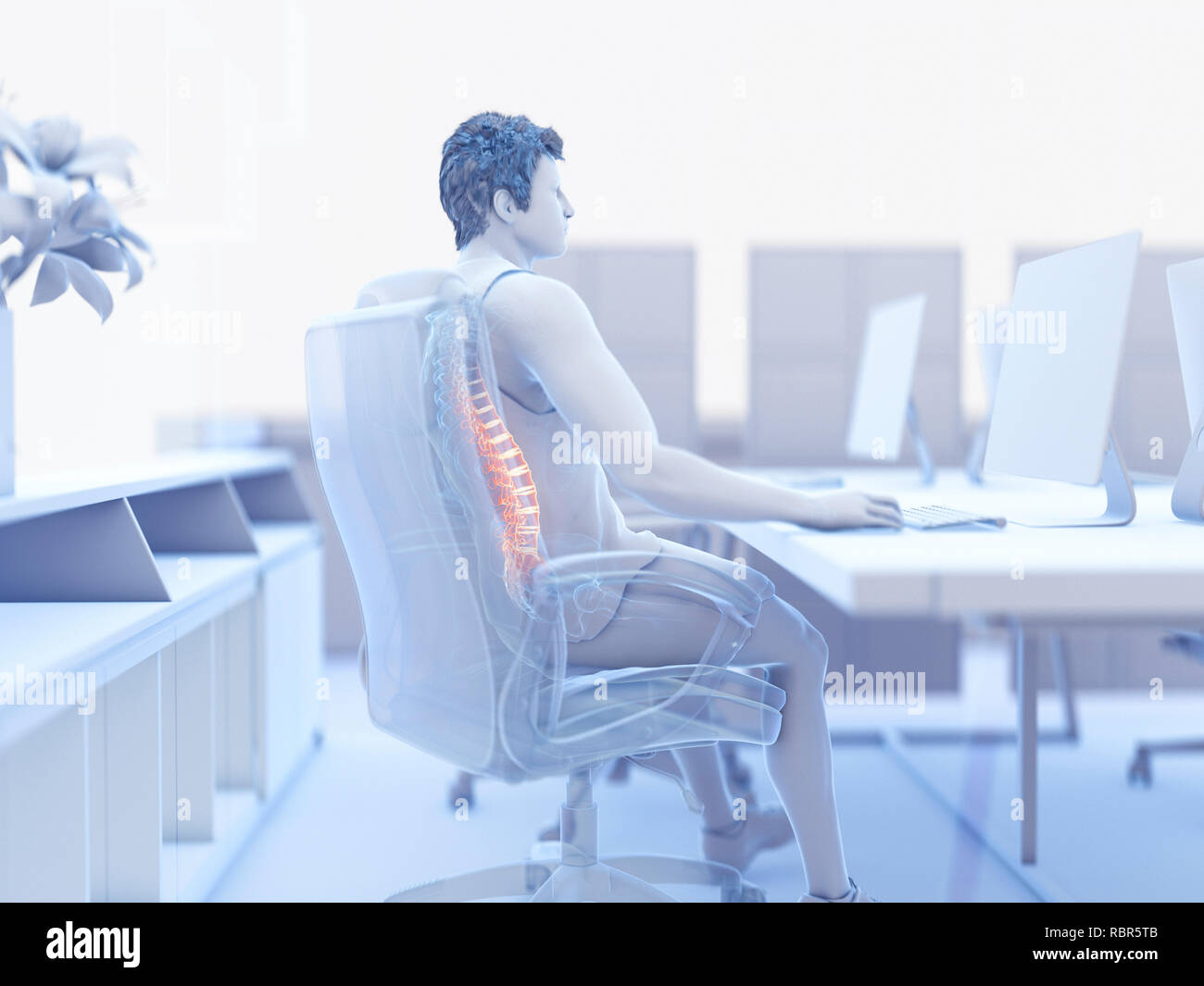 Illustration of an office worker with a painful back Stock Photo - Alamy